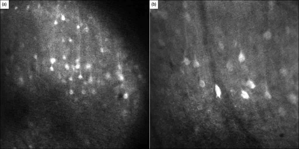 Thorlabs · イメージング用屈折率分布型(GRIN)レンズ